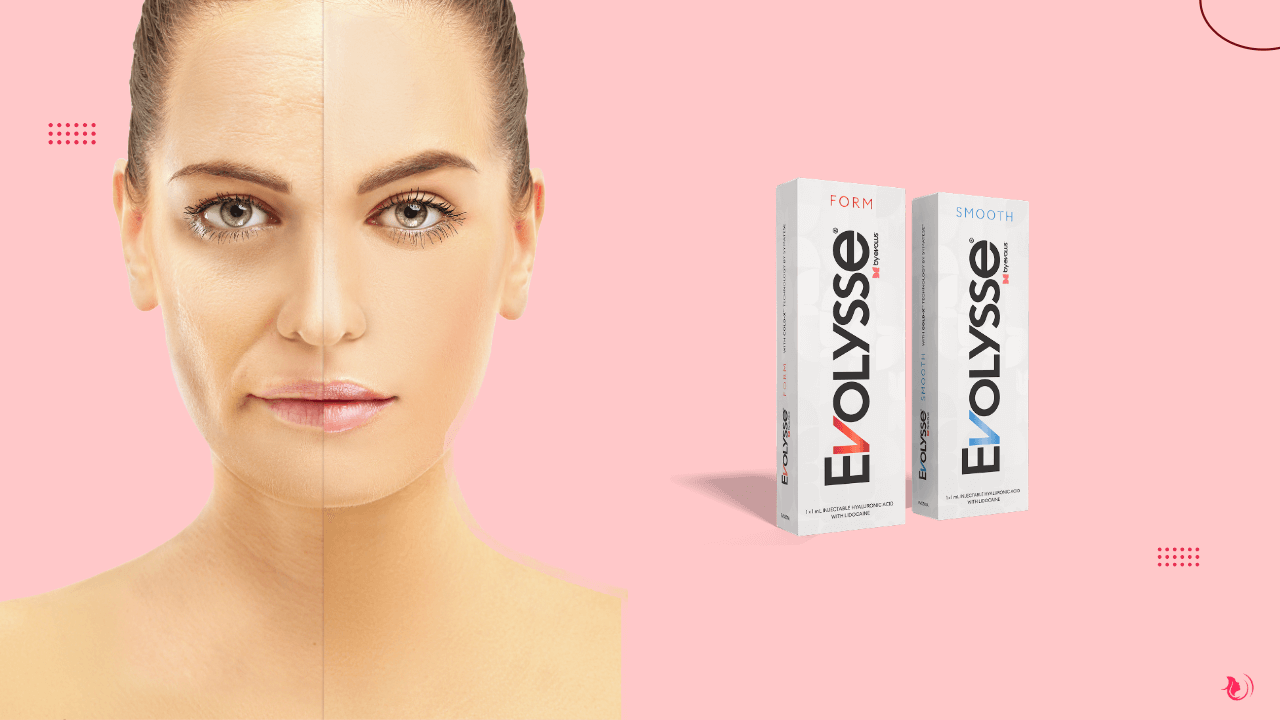 FDA Approves Evolysse Fillers For Nasolabial Folds