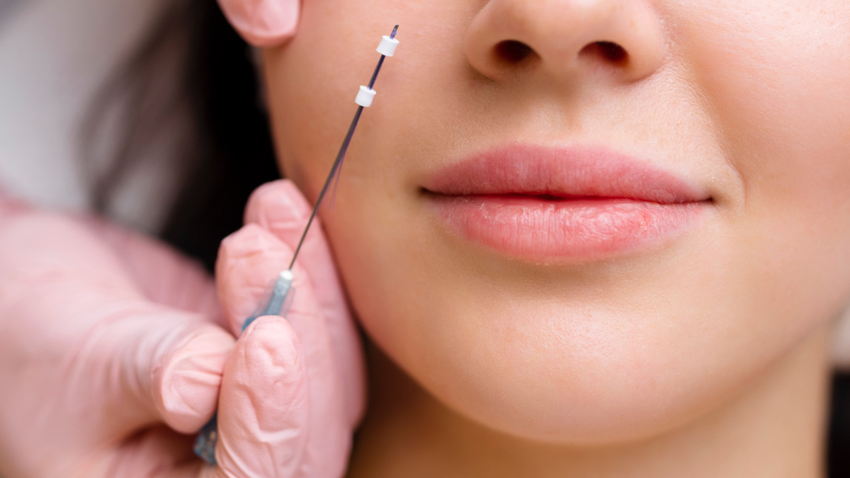PDO Threads Vs HIFU Facial: Which Is Right For You?