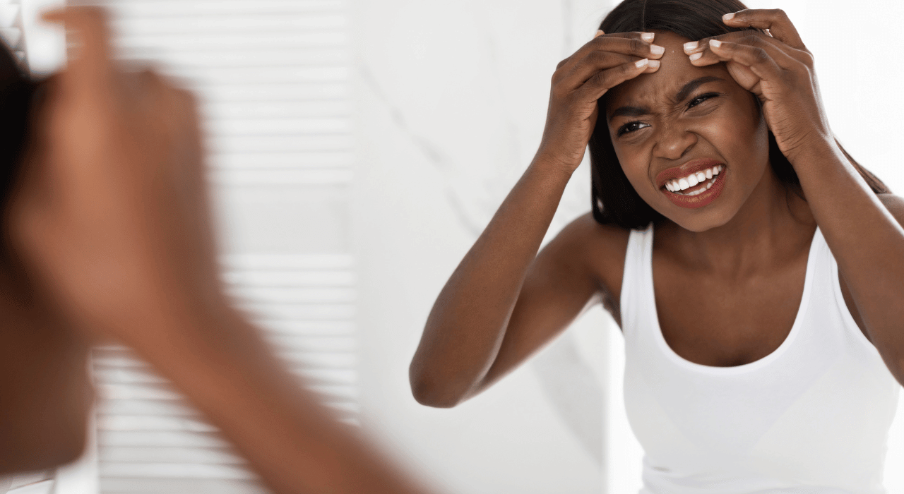 10 Essential Beauty Tips For Acne-Prone Skin