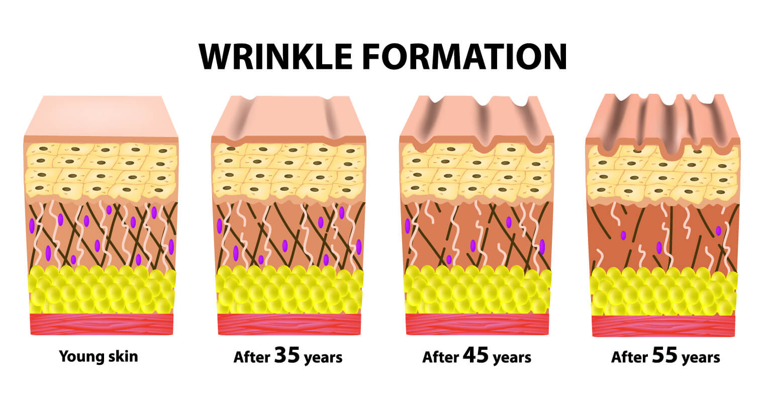 The Science Behind Wrinkles